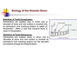 alveolar ridge expansion and socket preservation | PPT