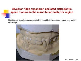 alveolar ridge expansion and socket preservation | PPT