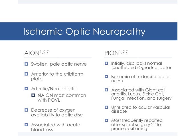 Ischemic Optic Neuropathy: A Sequala of Spinal Surgery