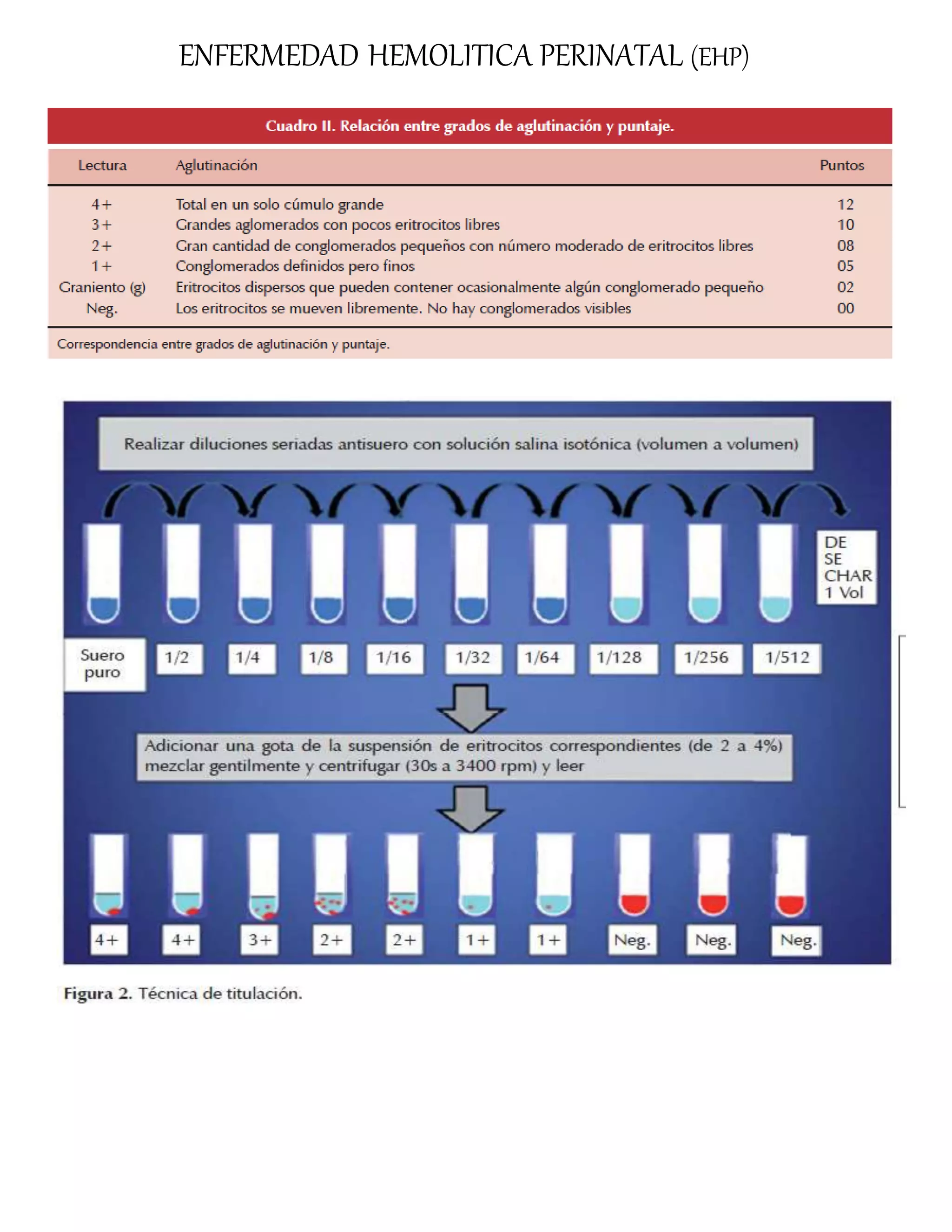 AHP - Anemia Hemolitica Perinatal | DOC