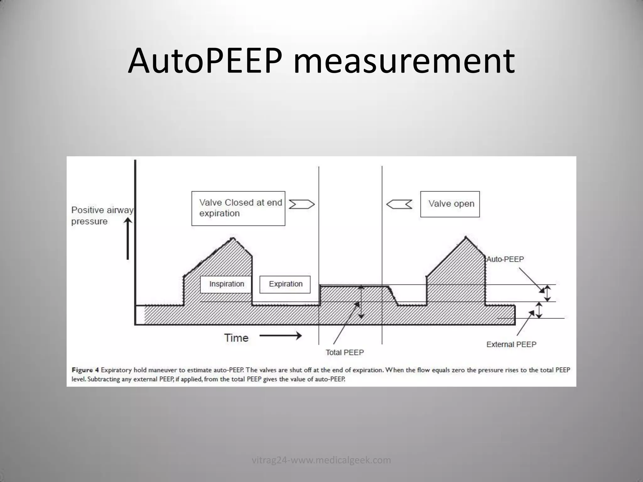 Ventilatory management of Acute Hypercapnic Respiratory Failure | PDF