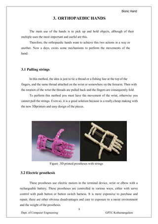 BIONIC HAND | PDF