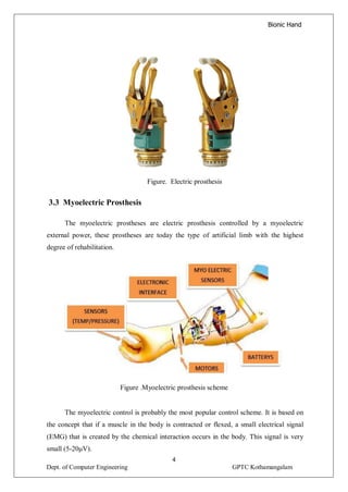 BIONIC HAND | PDF
