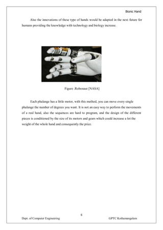 BIONIC HAND | PDF