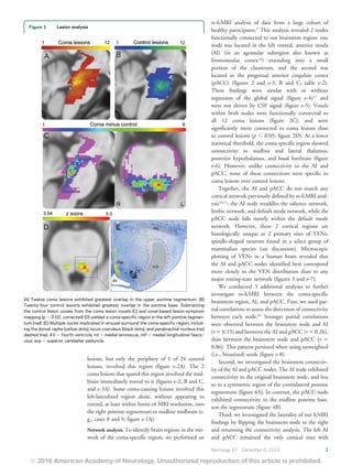 A human brain network derived from coma causing lesions (fisher et al ...