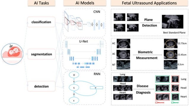 Artificial Intelligence in Obstetrics practice | PPTX