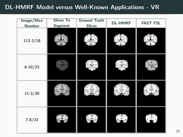 3D Brain Image Segmentation Model using Deep Learning and Hidden Markov Random Fields | PPT
