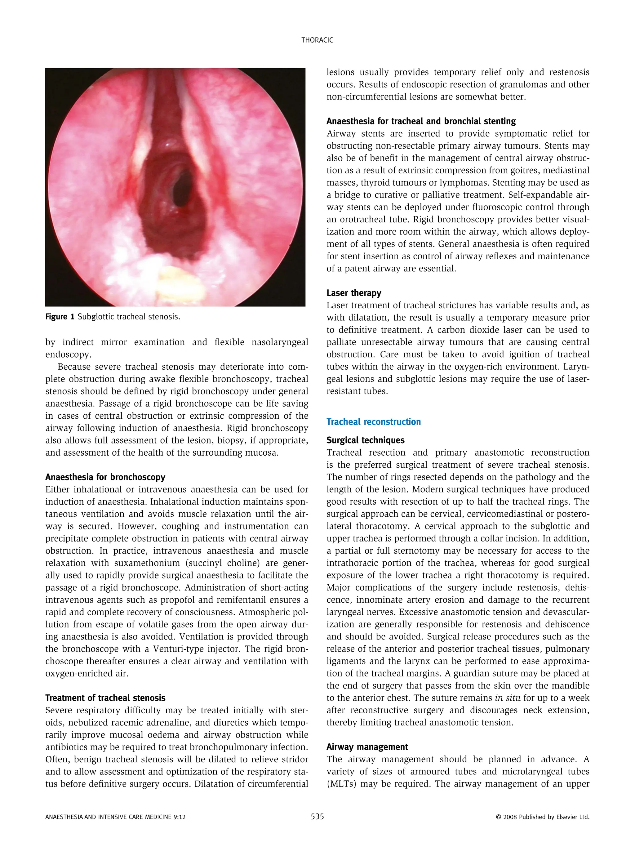 AICM - 2008 - Anaesthesia for tracheal and Airway surgery.pdf