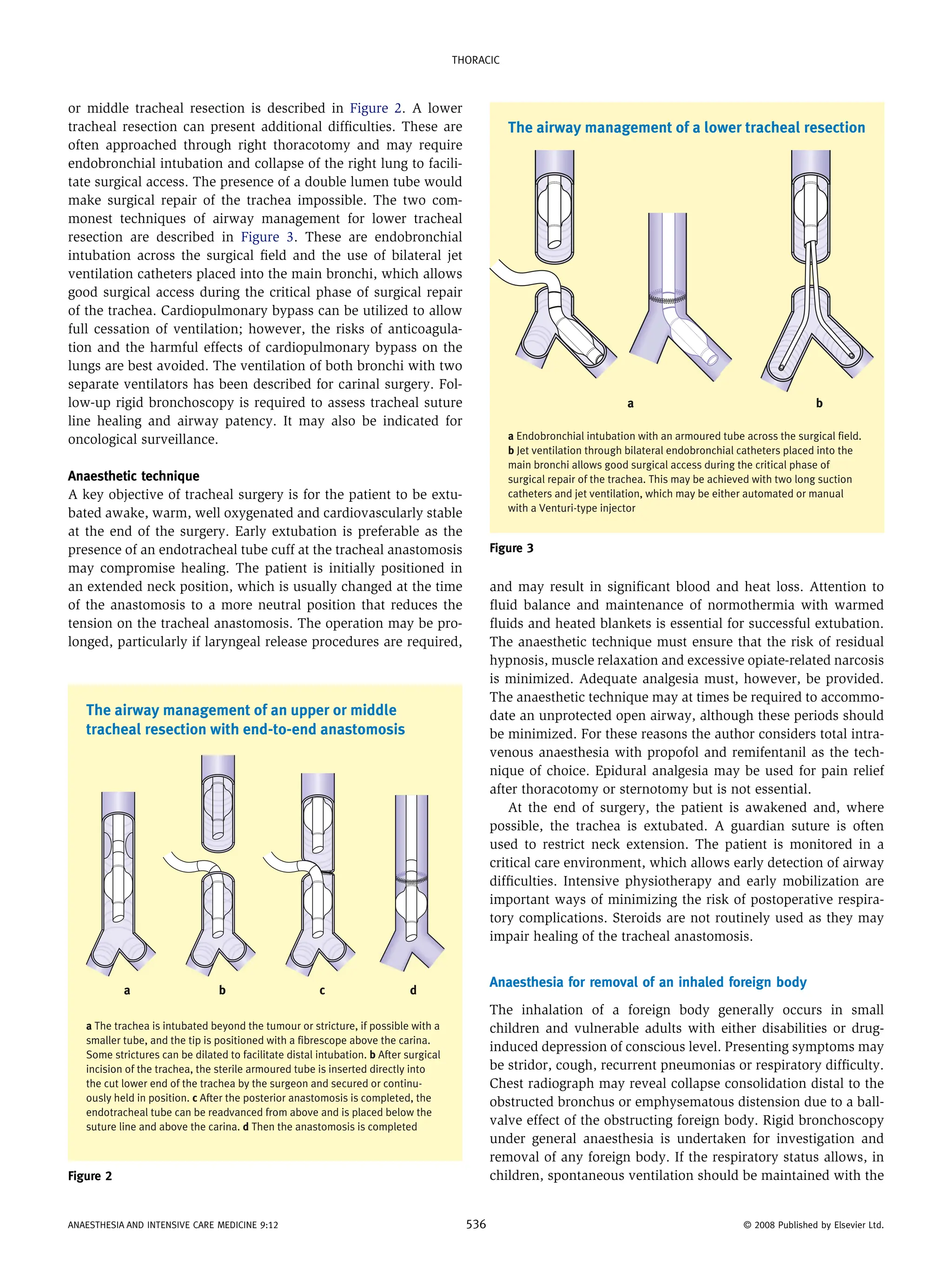 AICM - 2008 - Anaesthesia for tracheal and Airway surgery.pdf