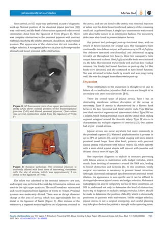 Crimson Publishers-A Newborn Presenting With Bilious Vomiting: A Case ...