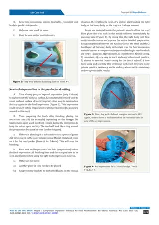 Compression Impression Technique for Fixed Prosthodontics: the Iskaros ...
