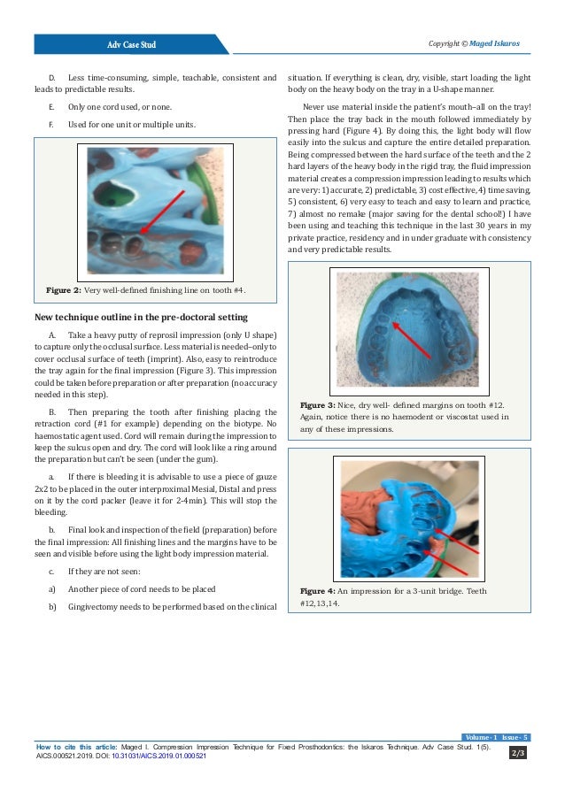 Compression Impression Technique For Fixed Prosthodontics The Iskaro