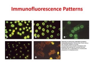 Auto antibodies in Autoimmune Connective Tissue Diseases | PPTX