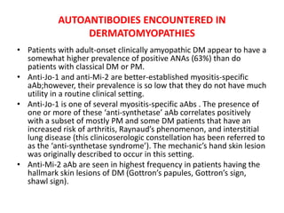 Auto antibodies in Autoimmune Connective Tissue Diseases | PPTX