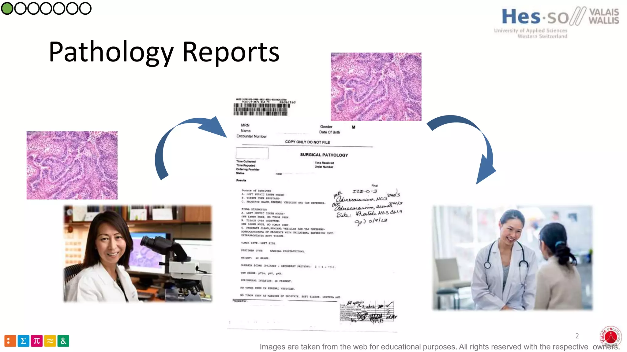 Classification of prostate cancer pathology reports using natural ...