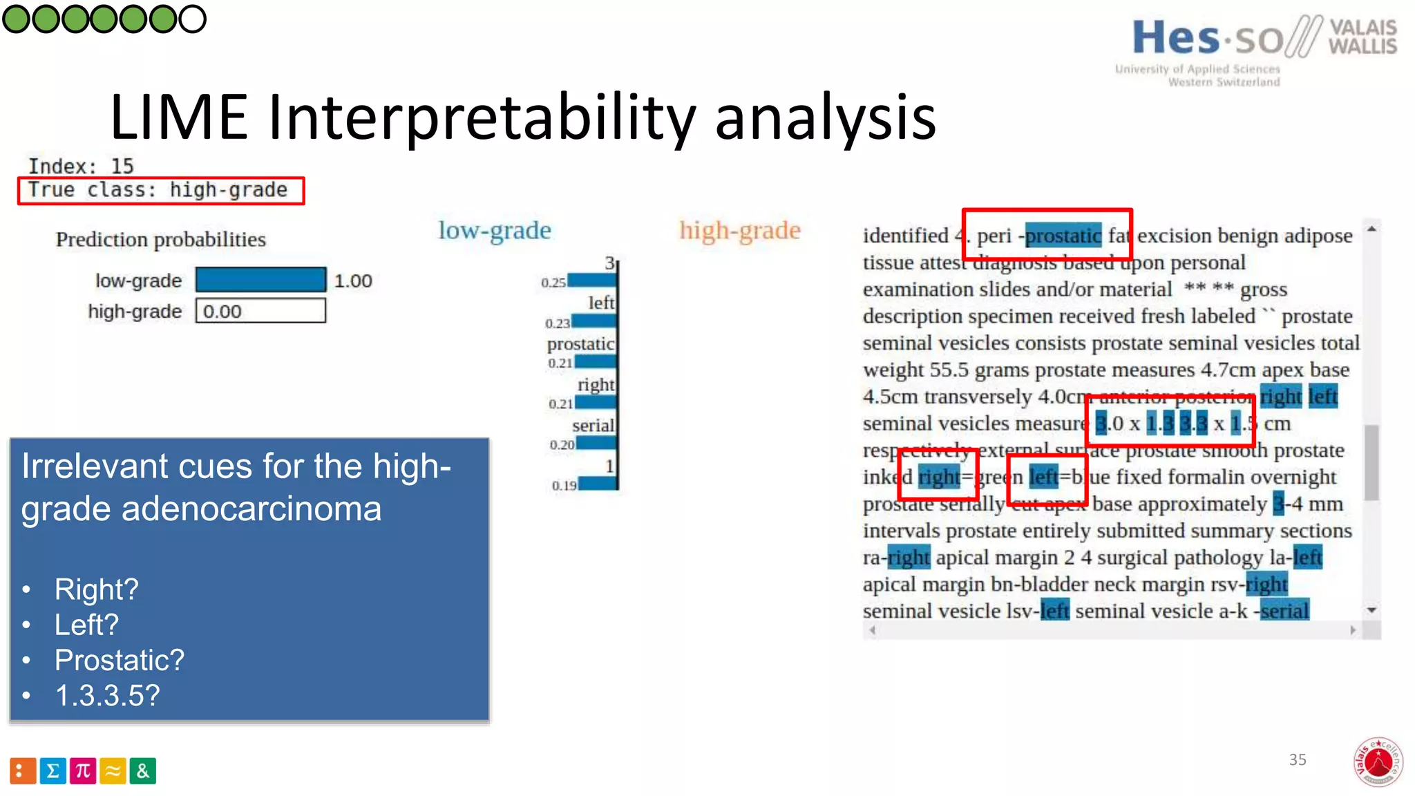 Classification of prostate cancer pathology reports using natural ...