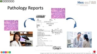 Classification of prostate cancer pathology reports using natural ...