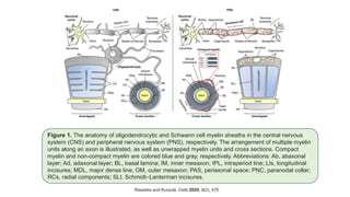 Acute inflammatory demylinating polyradiculneuropathy lecture.pptx