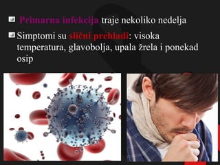 AIDS | PPT
