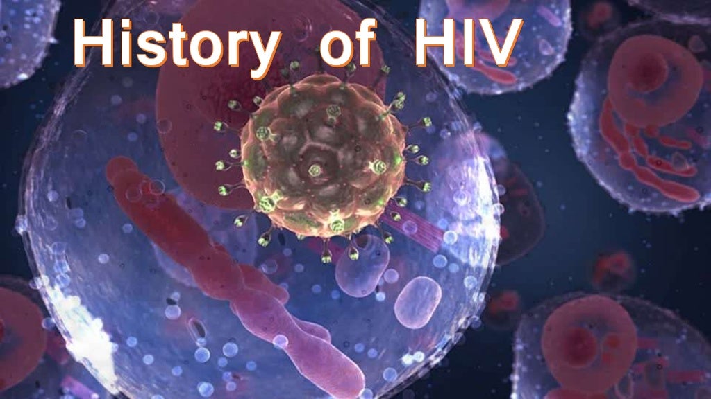 History of HIV/AIDS