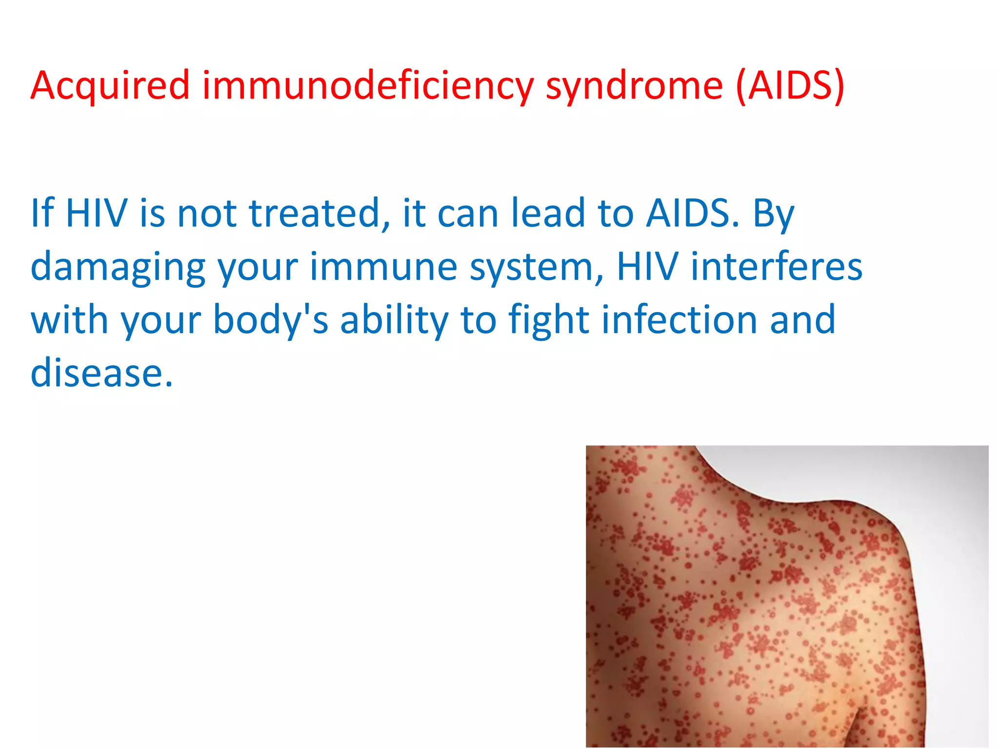 aids and malaria.pptx