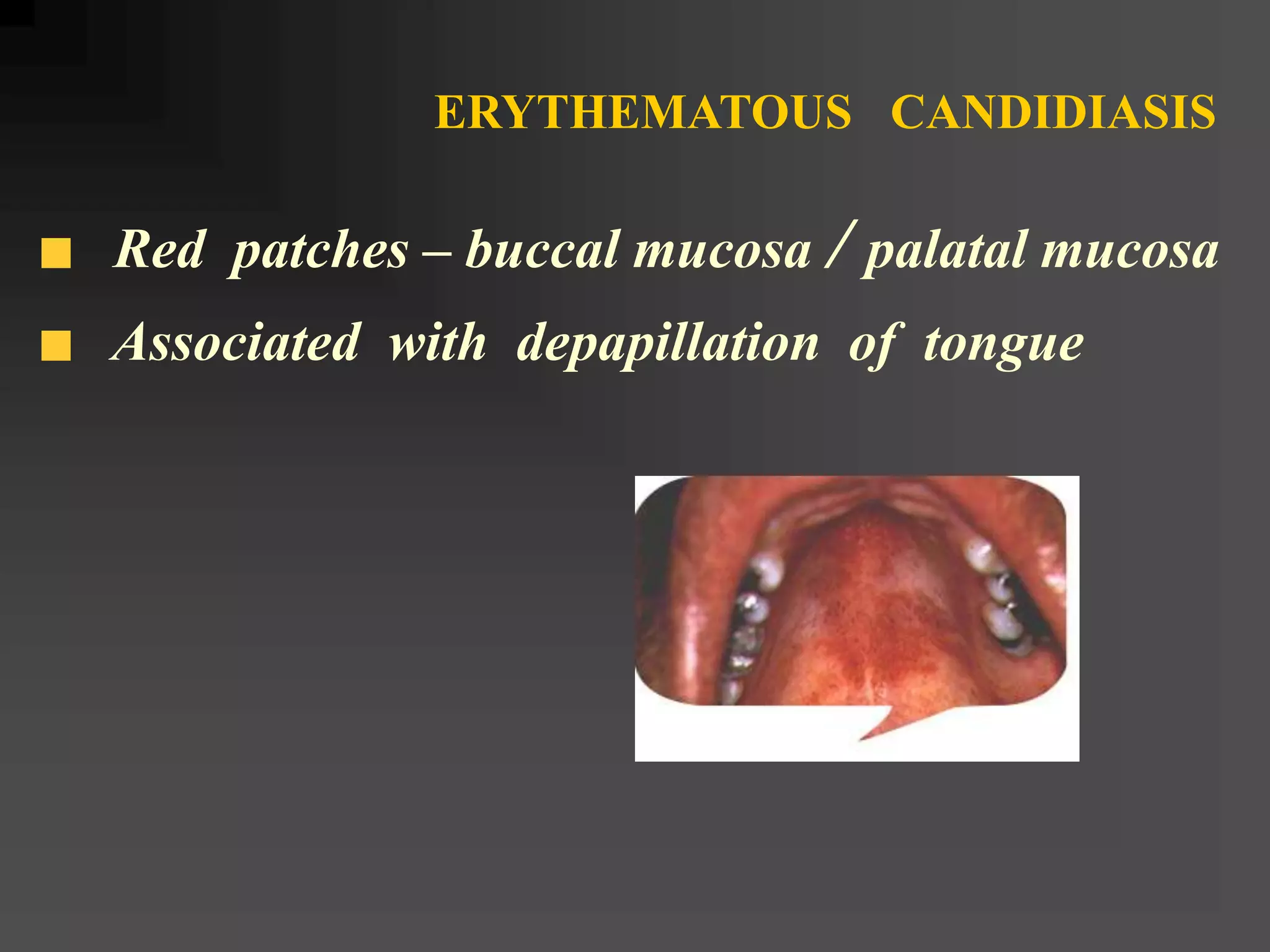 AIDS AND PERIODONTIUM.ppt