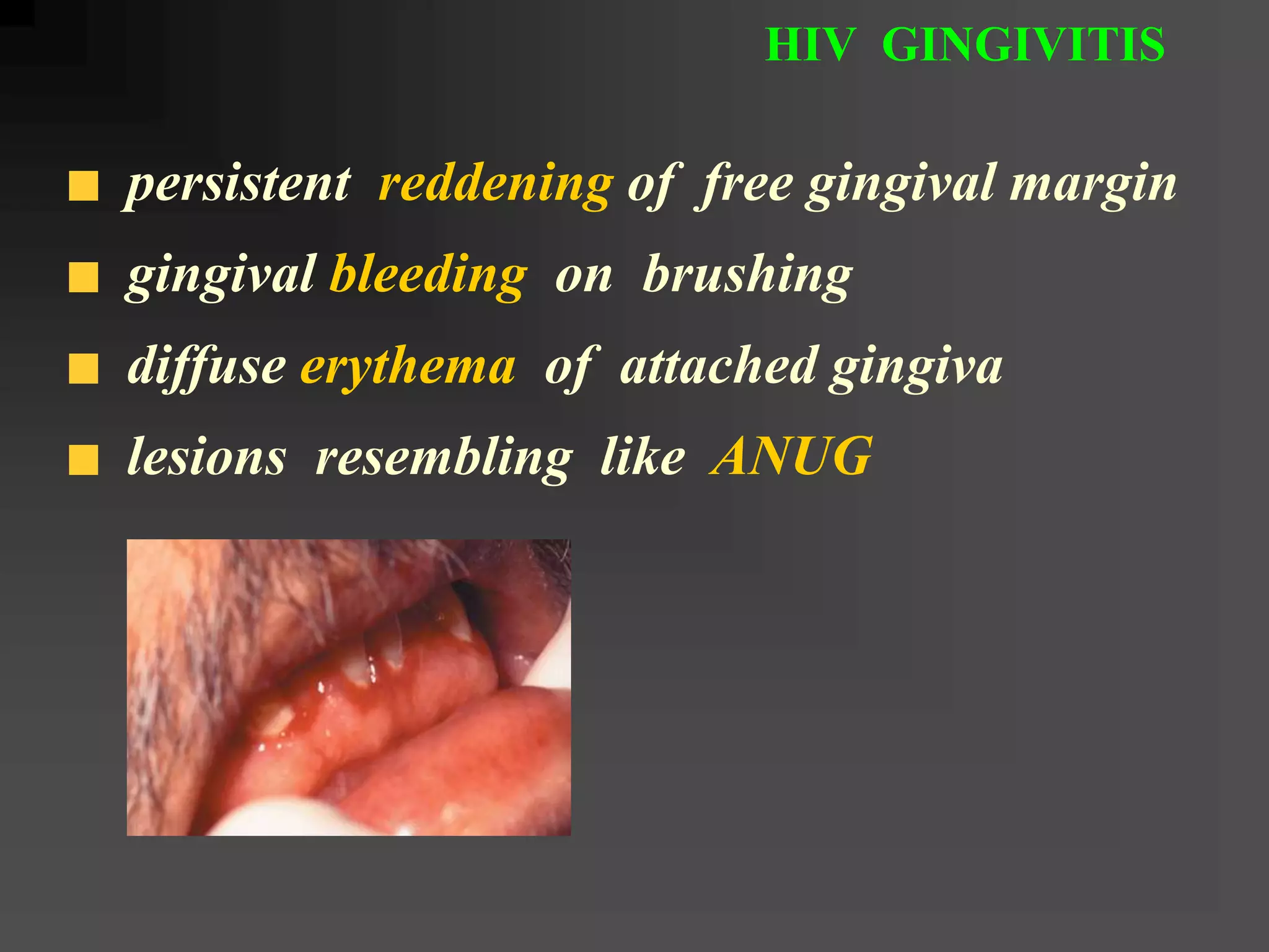 AIDS AND PERIODONTIUM.ppt