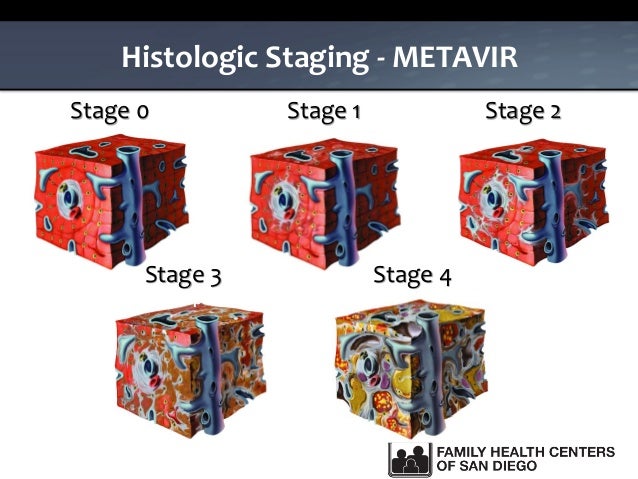 The HCV Treatment Revolution: A View from the Community Health Center