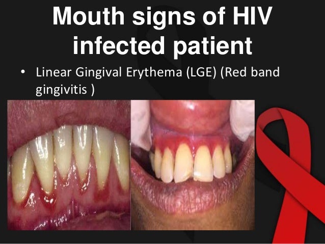 Aids for dental students