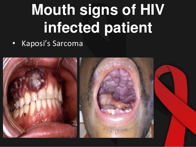 Aids for dental students