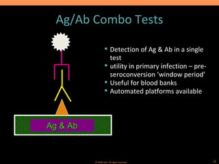 AIDS/HIV Testing Methodology (www.ubio.in) | PPT