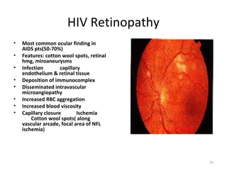 Hiv Retinopathy Symptoms