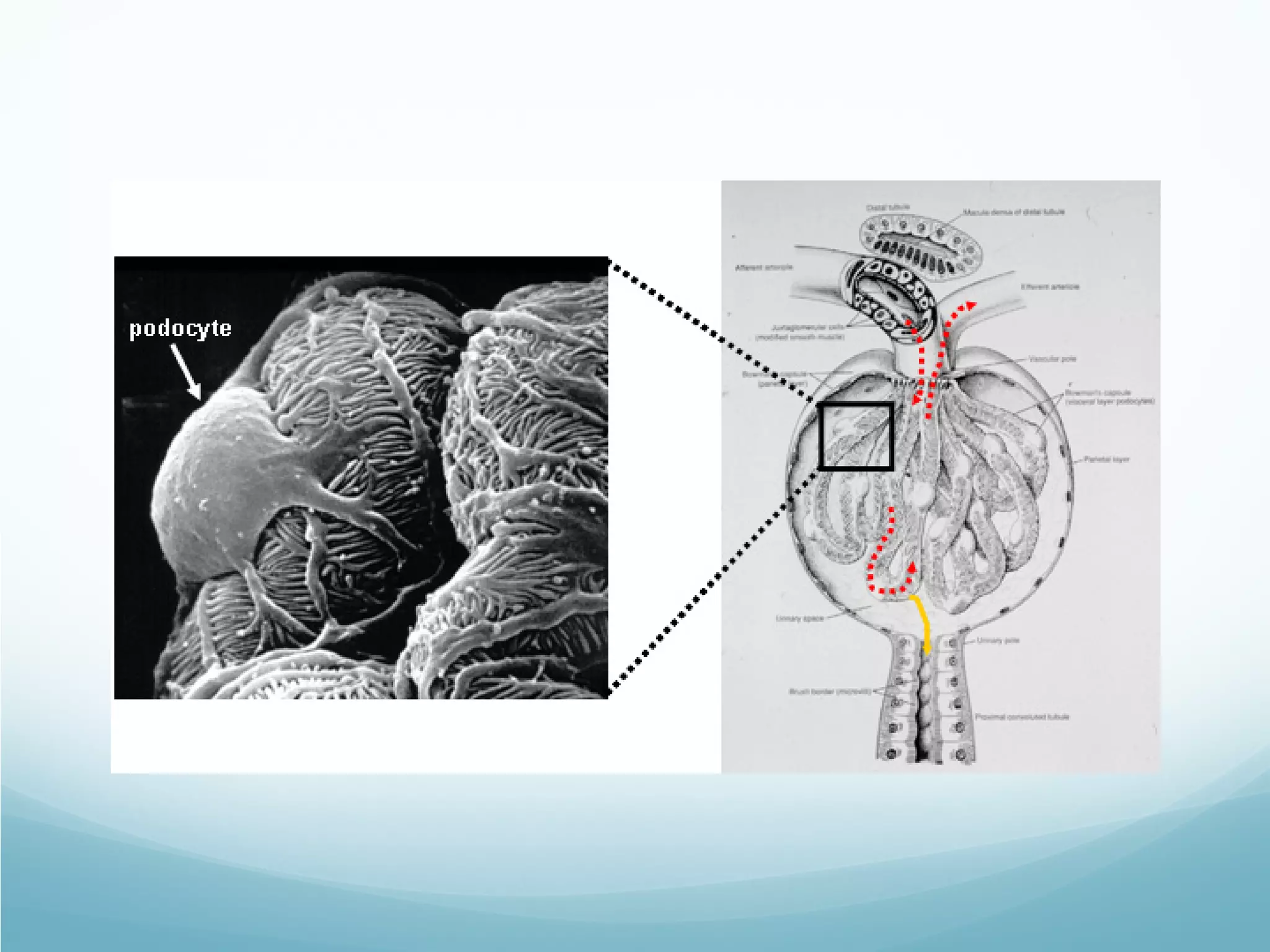 Renal Disease in HIV/AIDS | PDF