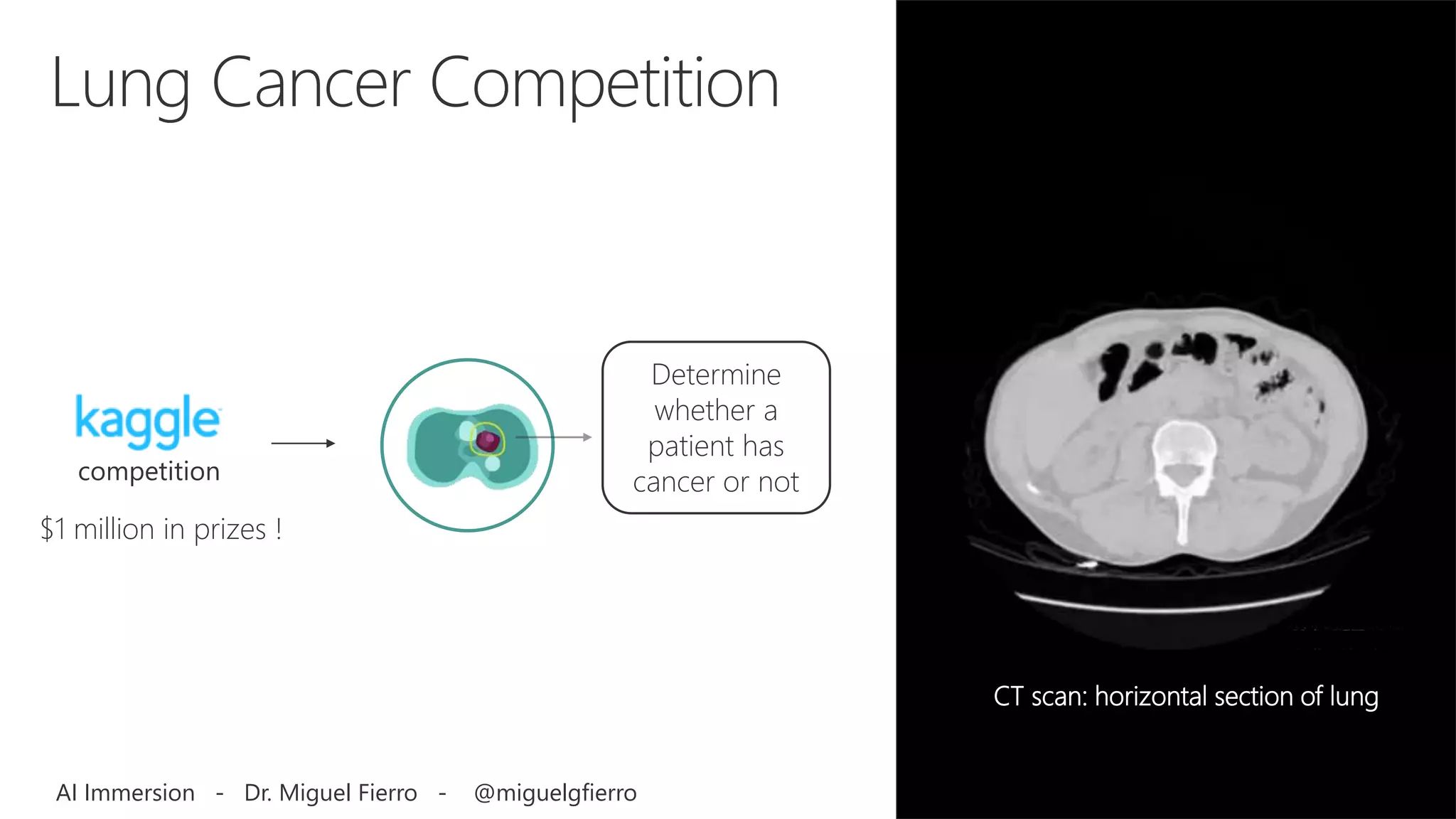 Deep Learning for Lung Cancer Detection | PPTX