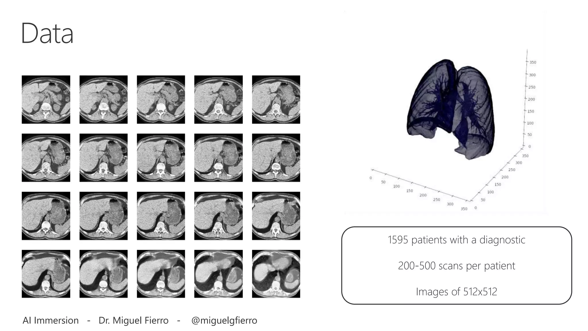 Deep Learning for Lung Cancer Detection | PPTX