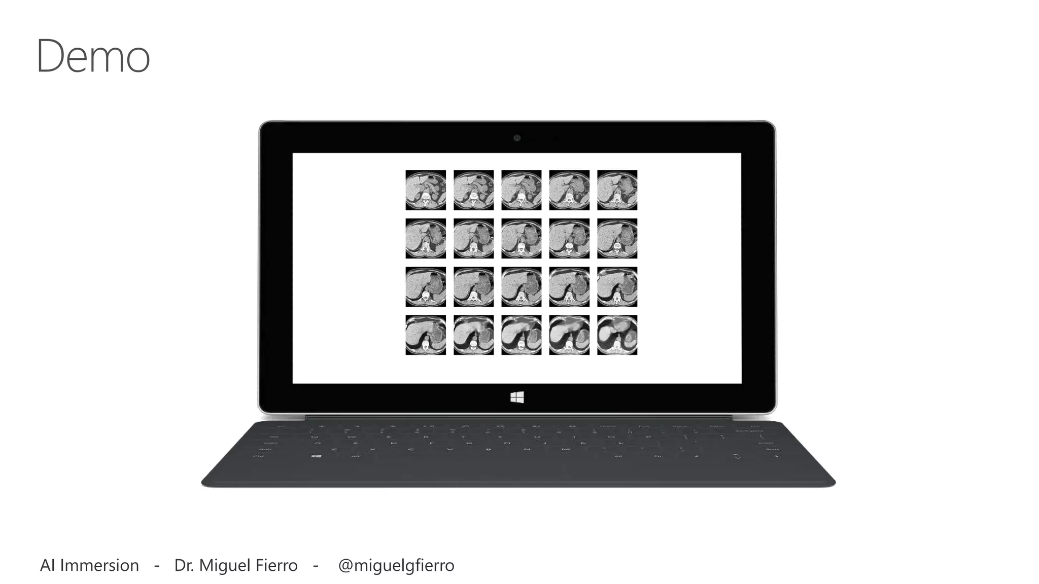 Deep Learning for Lung Cancer Detection | PPTX