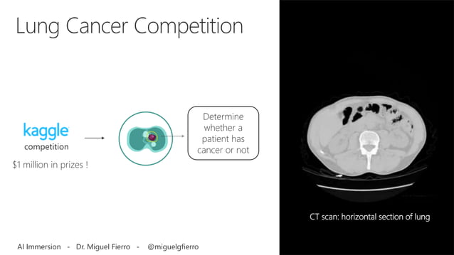 Deep Learning for Lung Cancer Detection | PPTX
