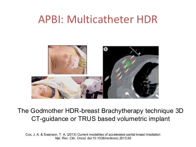 Advances in Brachytherapy Treatment Planning and Delivery