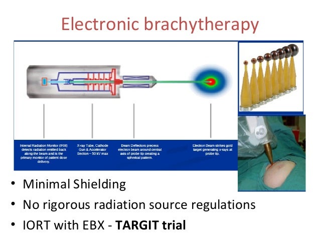 Advances in Brachytherapy Treatment Planning and Delivery