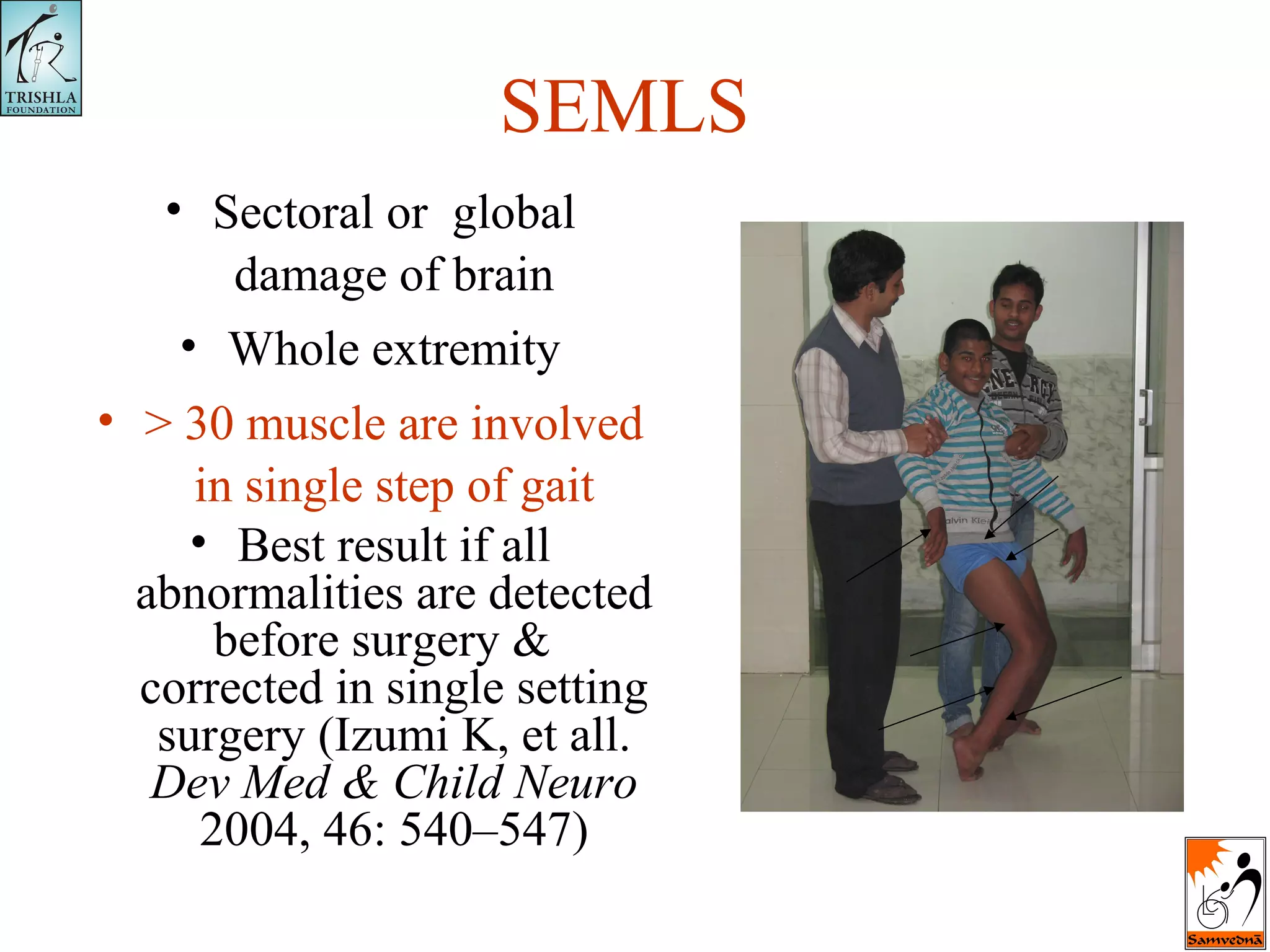 Holistic concept in treatment of Cerebral Palsy | PPT | Death, Injury ...