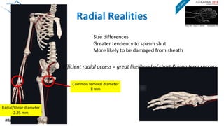 PCI & AimRadial 2018 | Radial Artery Puncture - Ian C Gilchrist | PPTX