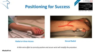 PCI & AimRadial 2018 | Radial Artery Puncture - Ian C Gilchrist | PPTX