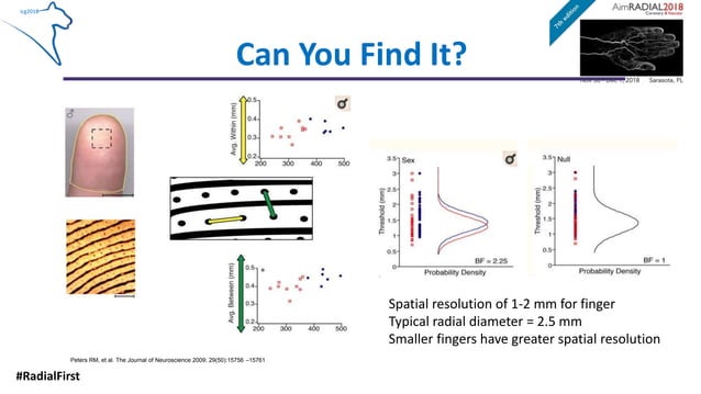 PCI & AimRadial 2018 | Radial Artery Puncture - Ian C Gilchrist | PPTX