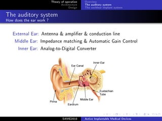 AIMD design and examples | PPT | Free Download