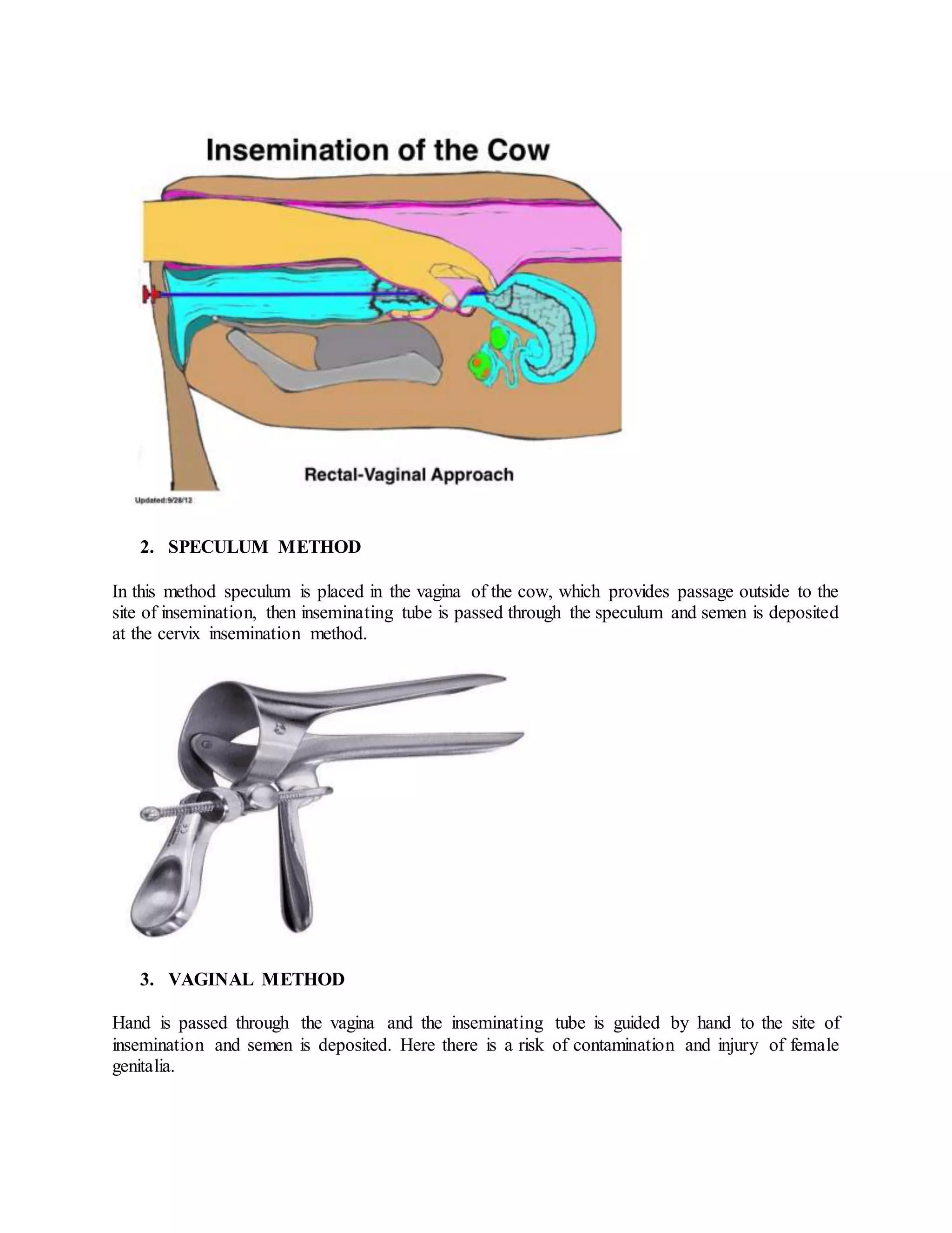 Artificial Insemination | DOCX