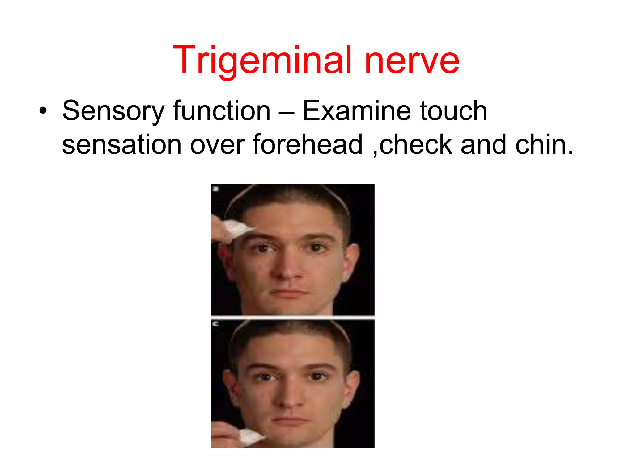 Aim –Examination of cranial nerve.ppt