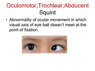 Aim –Examination of cranial nerve.ppt