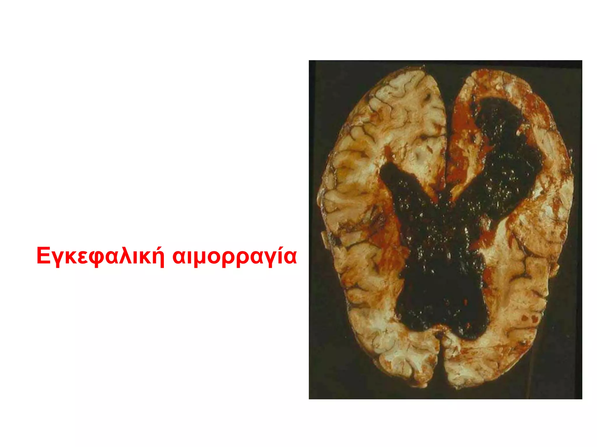 AIMOΔΥΝΑΜΙΚΕΣ ΔΙΑΤΑΡΑΧΕΣ.ppt