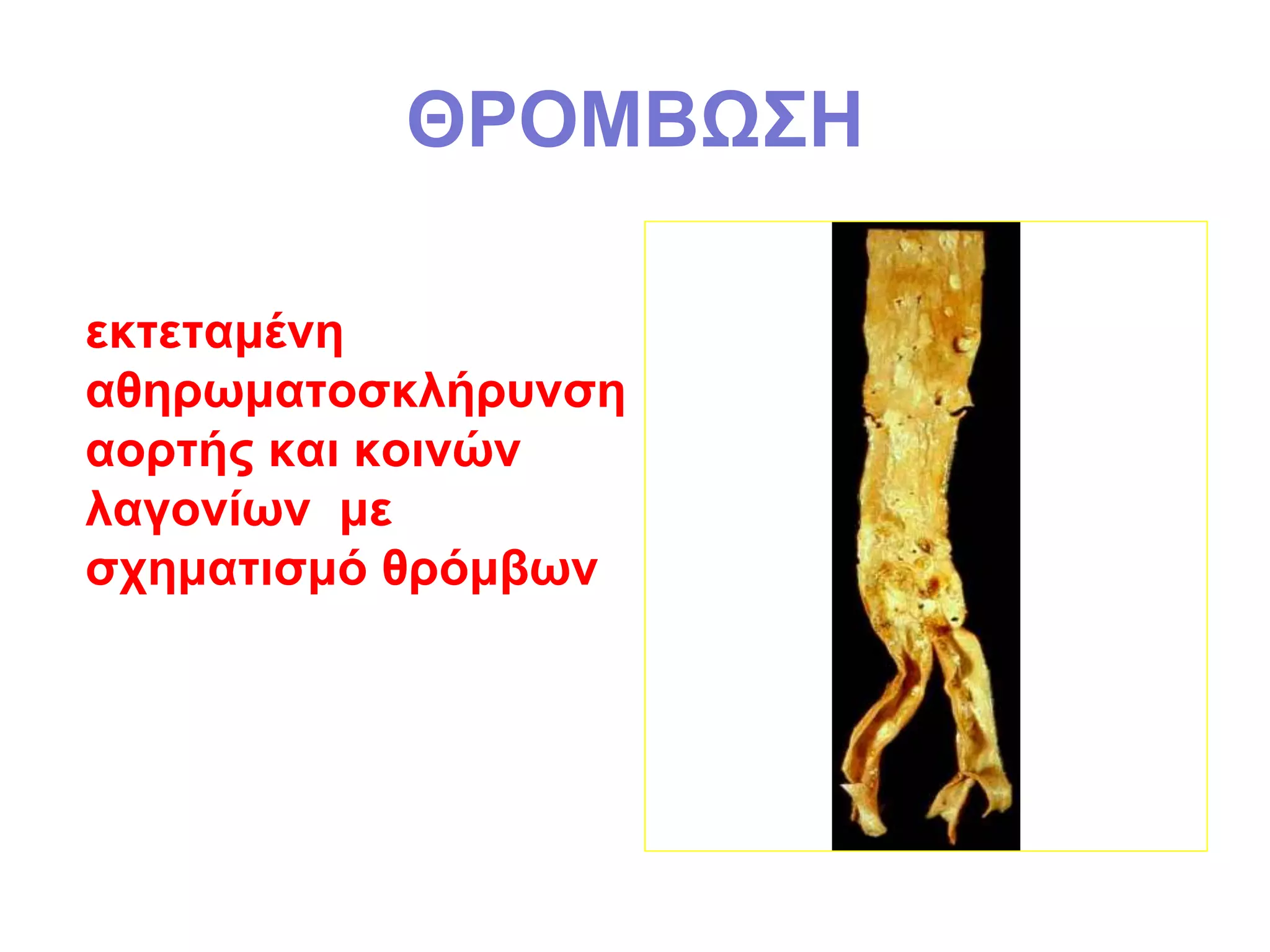 AIMOΔΥΝΑΜΙΚΕΣ ΔΙΑΤΑΡΑΧΕΣ.ppt