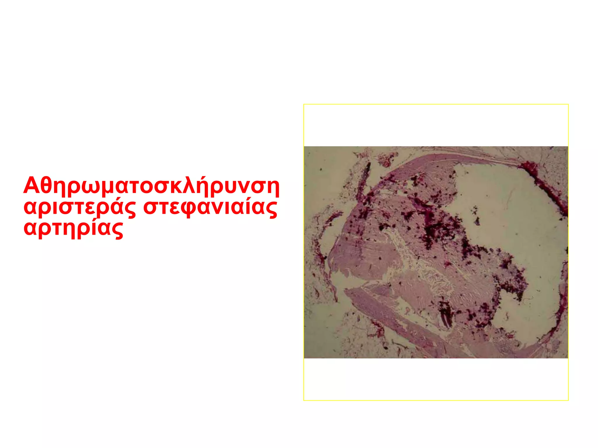 AIMOΔΥΝΑΜΙΚΕΣ ΔΙΑΤΑΡΑΧΕΣ.ppt